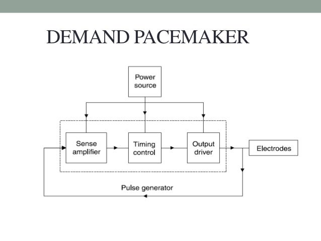 Pacemakers ppt1
