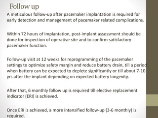 Cardiac Pacemakers | PPT