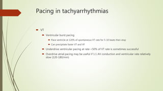 Pacemakers and implantable cardiac defibrillators | PPTX