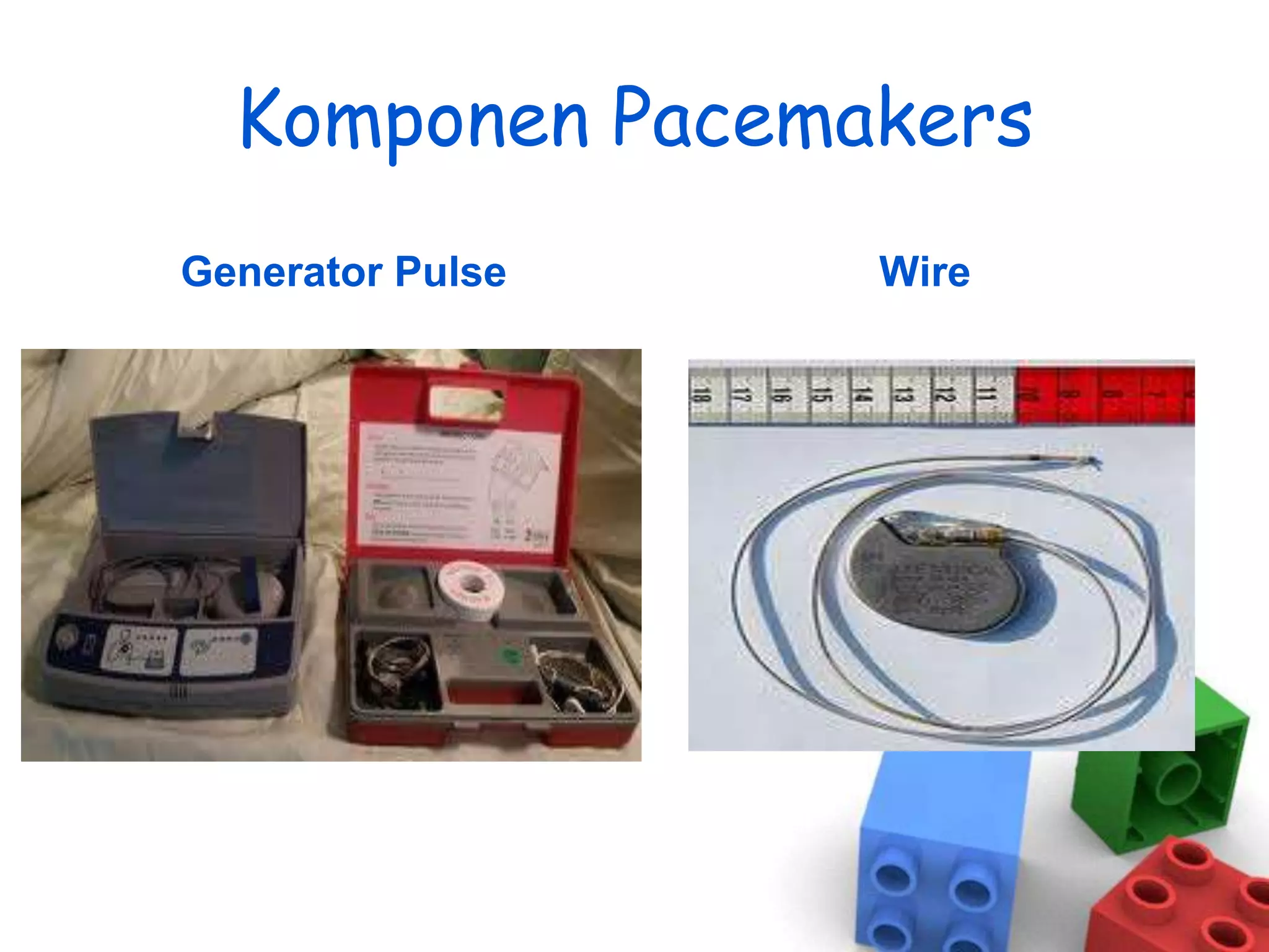 Penatalaksanaan dental Anak Dengan Gangguan Sistem Kardiovaskular ...