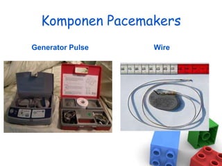 Penatalaksanaan dental Anak Dengan Gangguan Sistem Kardiovaskular ...