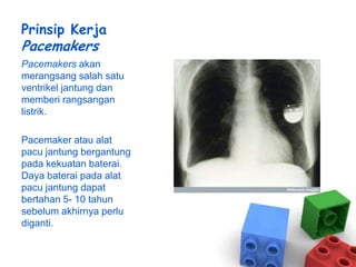 Penatalaksanaan dental Anak Dengan Gangguan Sistem Kardiovaskular ...