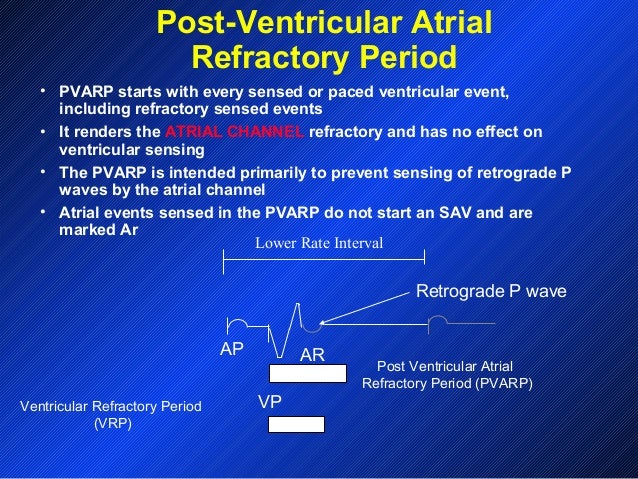 Pacemaker timing & advanced dual chamber concepts