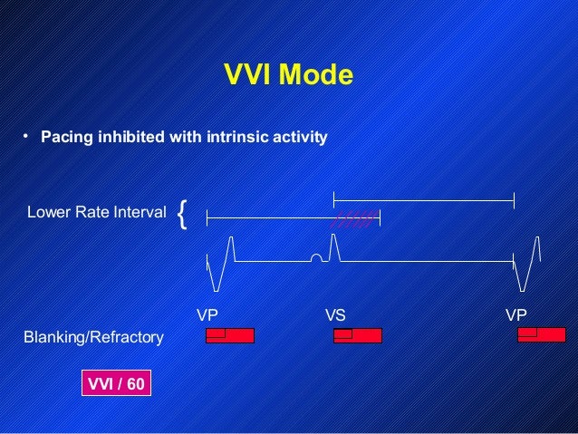 Pacemaker timing & advanced dual chamber concepts
