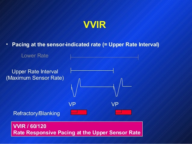 Pacemaker timing & advanced dual chamber concepts