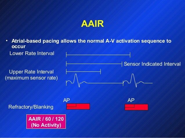 Pacemaker timing & advanced dual chamber concepts