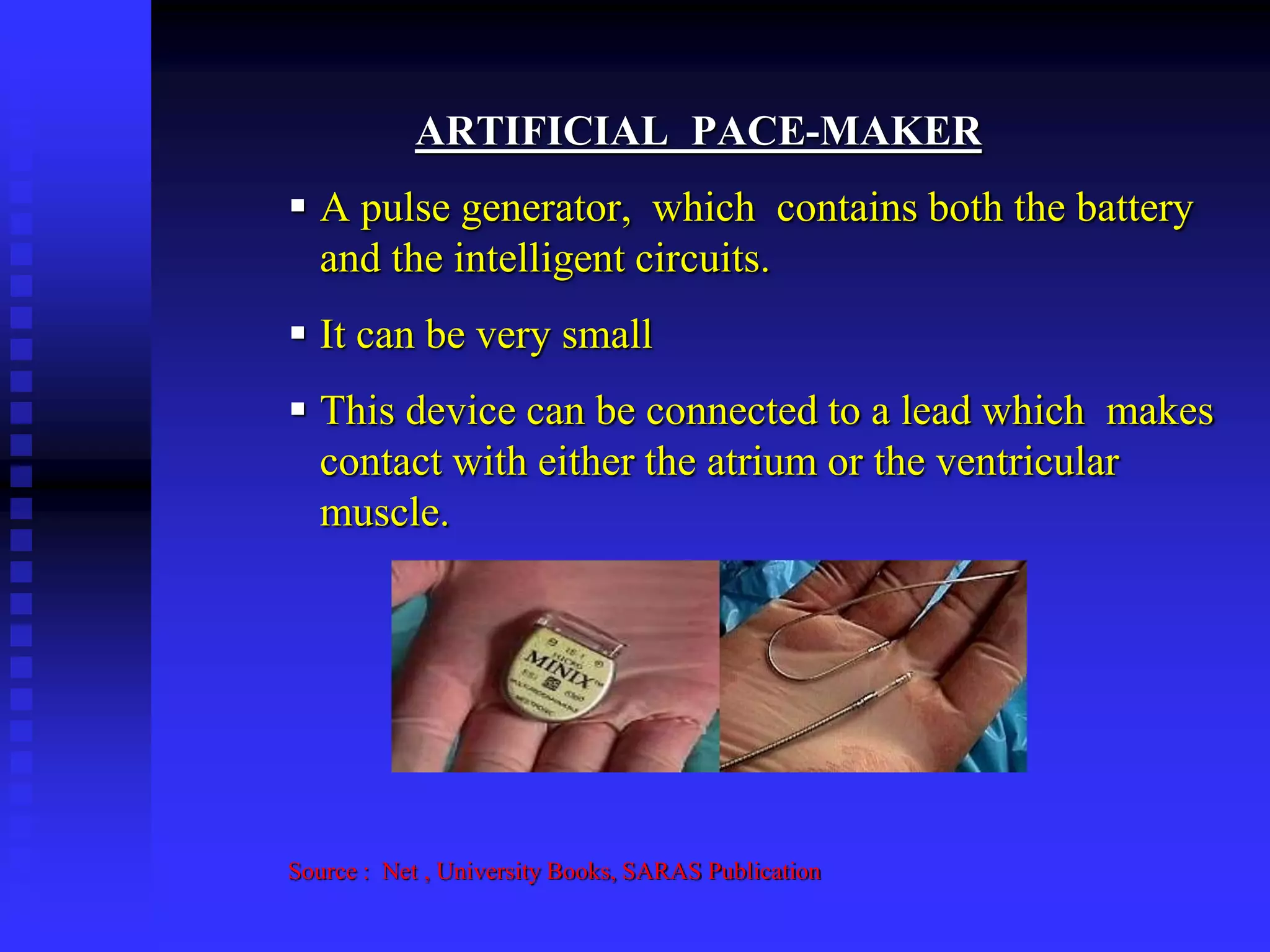 Pace maker tissues of the heart | PPT