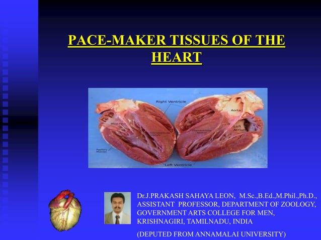 Pace maker tissues of the heart | PPT | Heart and Cardiovascular ...