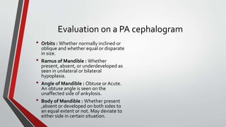 Posteroanterior Cephalometrics in orthodontics.pptx
