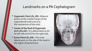 Posteroanterior Cephalometrics in orthodontics.pptx