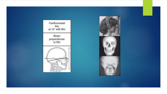 Pa(posteroanterior) cephalometry | PPTX | Ear, Nose and Throat ...
