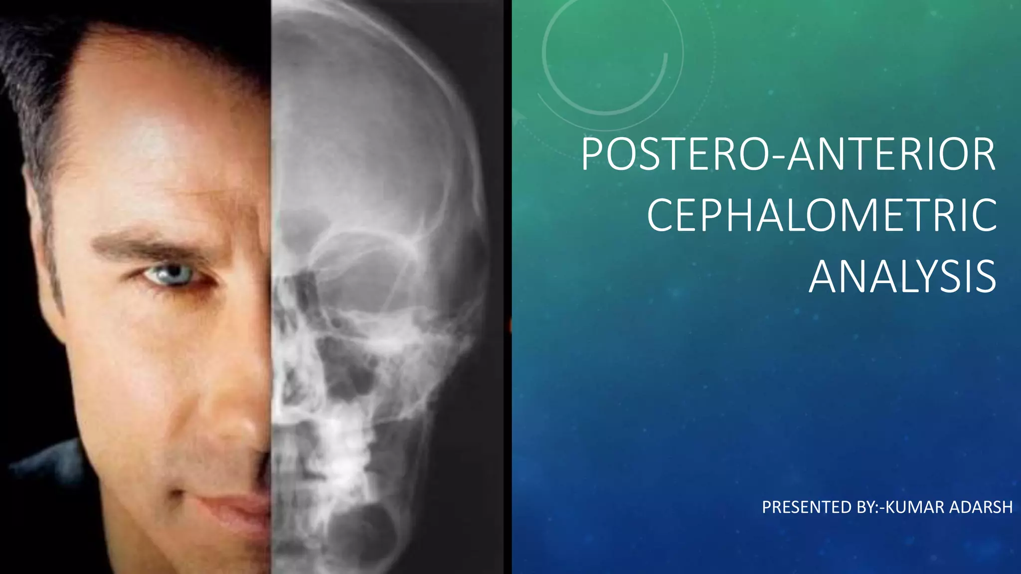 Pa ceph analysis | PPTX