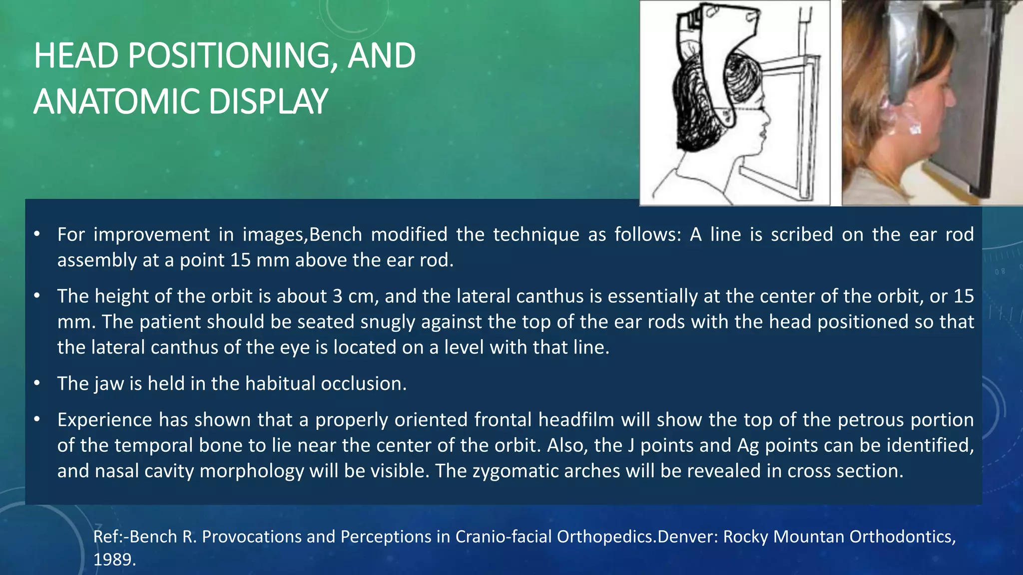 Pa ceph analysis | PPTX