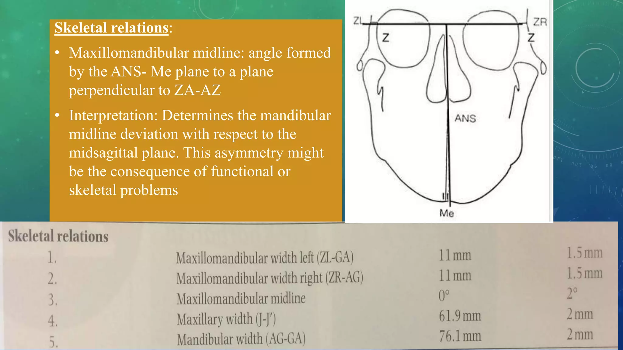 Pa ceph analysis | PPTX