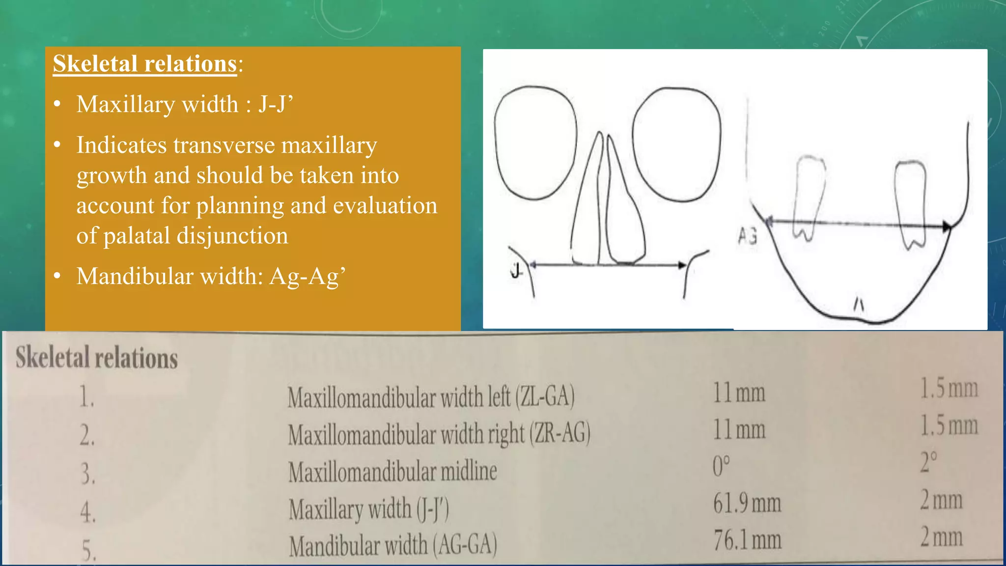 Pa ceph analysis | PPTX