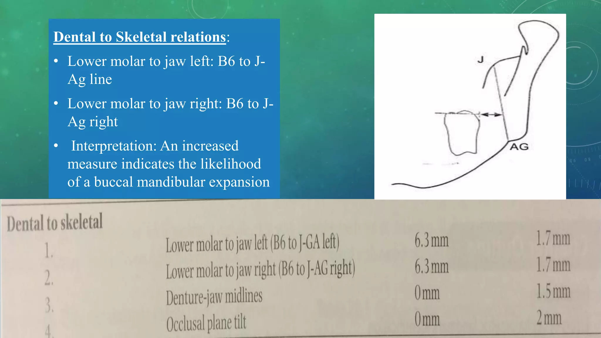 Pa ceph analysis | PPTX