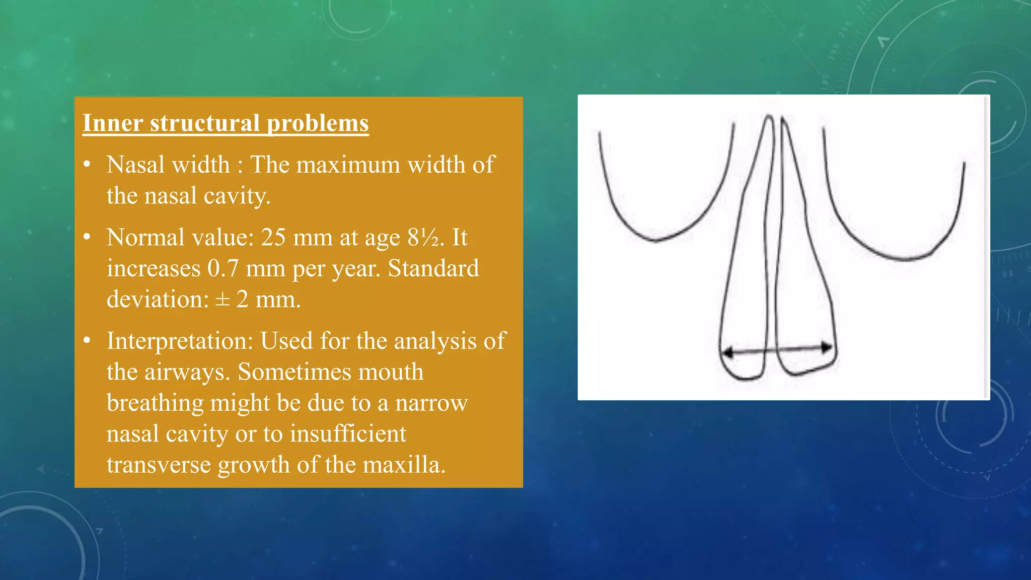 Pa ceph analysis | PPTX