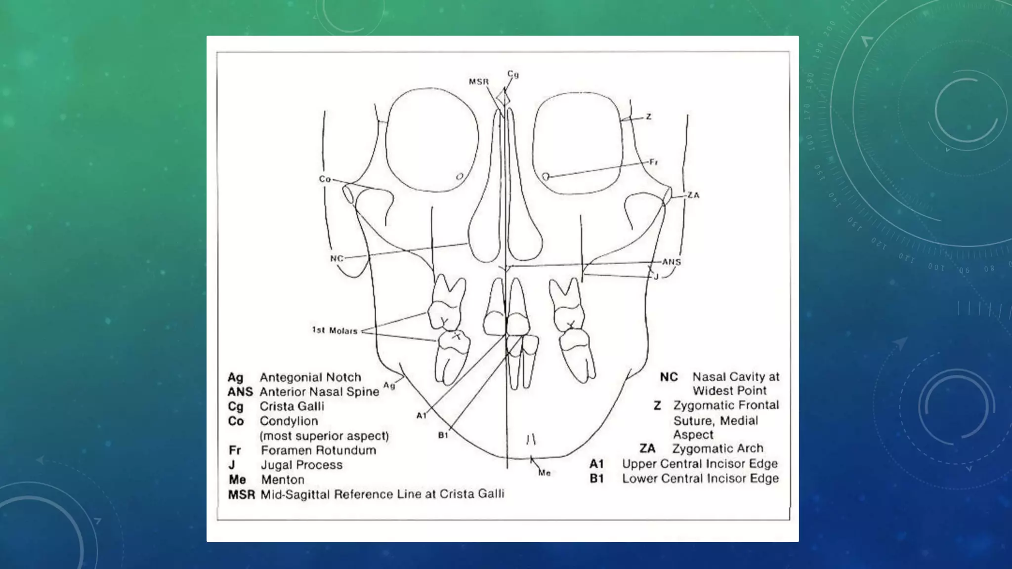 Pa ceph analysis | PPTX