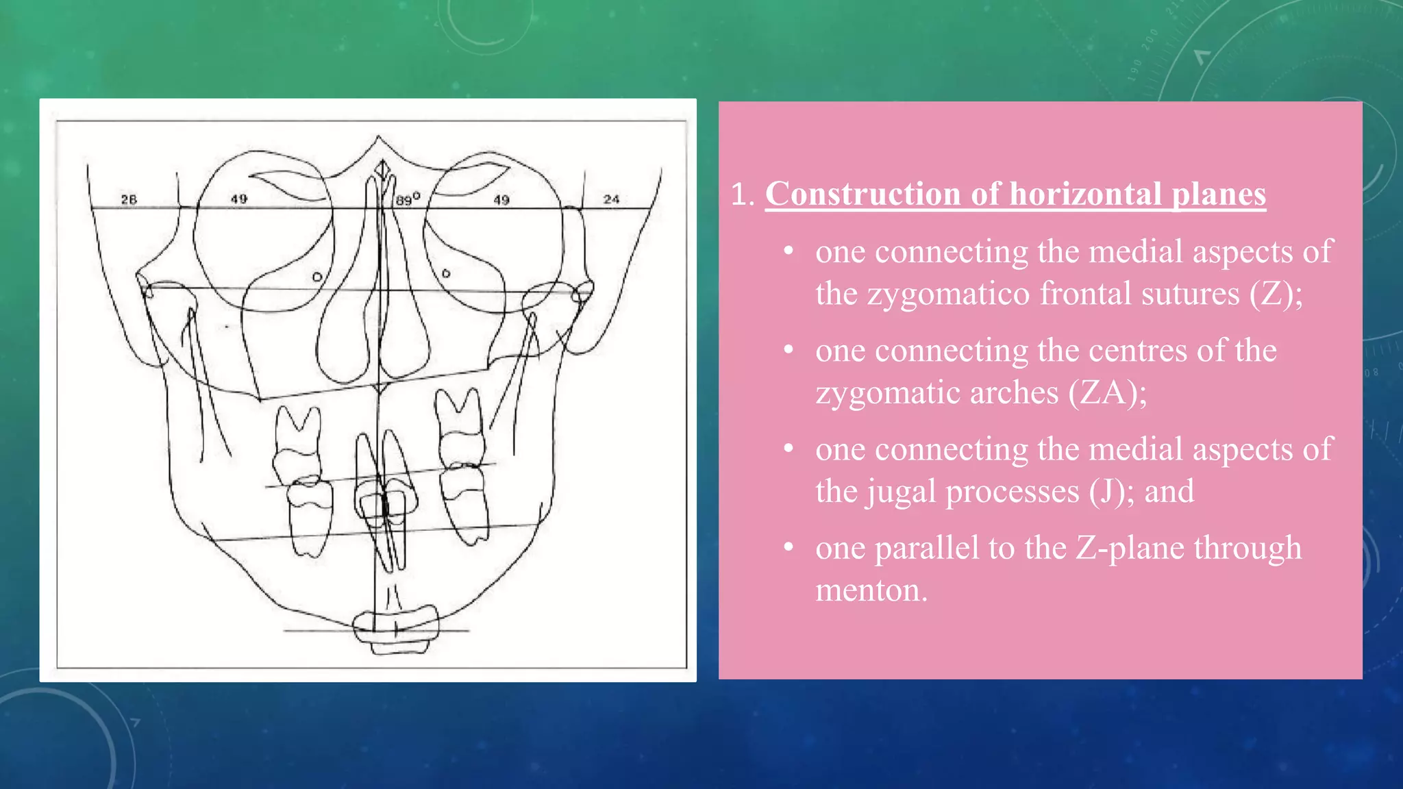 Pa ceph analysis | PPTX