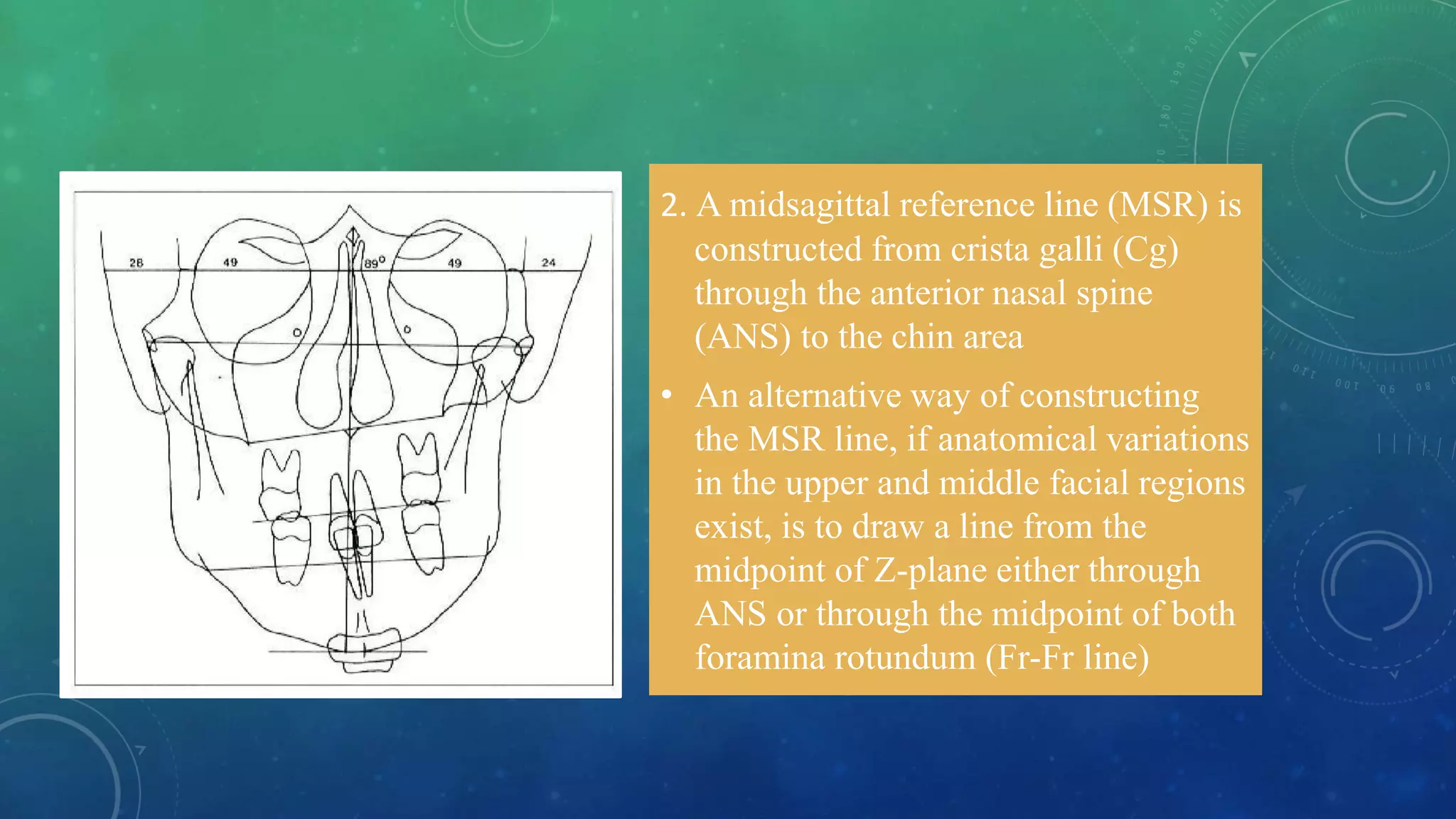 Pa ceph analysis | PPTX