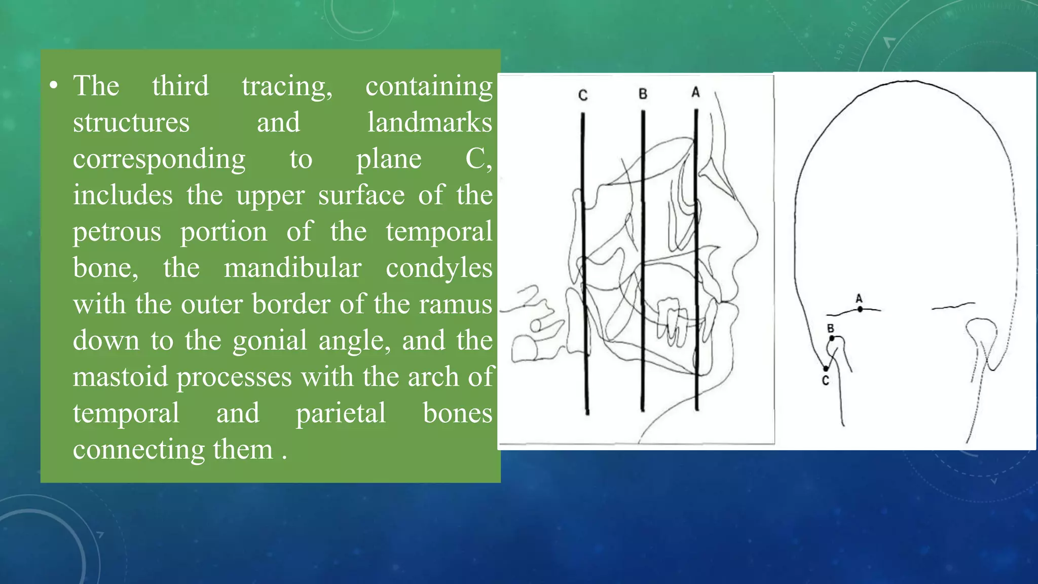Pa ceph analysis | PPTX