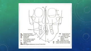 Pa ceph analysis | PPTX