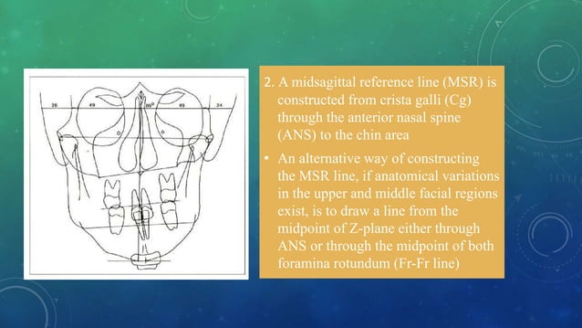 Pa ceph analysis | PPTX