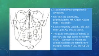 Pa ceph analysis | PPTX