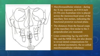 Pa ceph analysis | PPTX