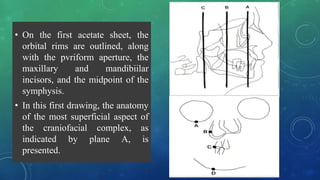 Pa ceph analysis | PPTX
