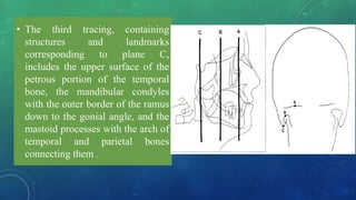 Pa ceph analysis | PPTX