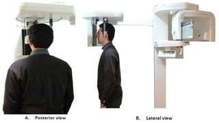 Pa ceph analysis | PPTX