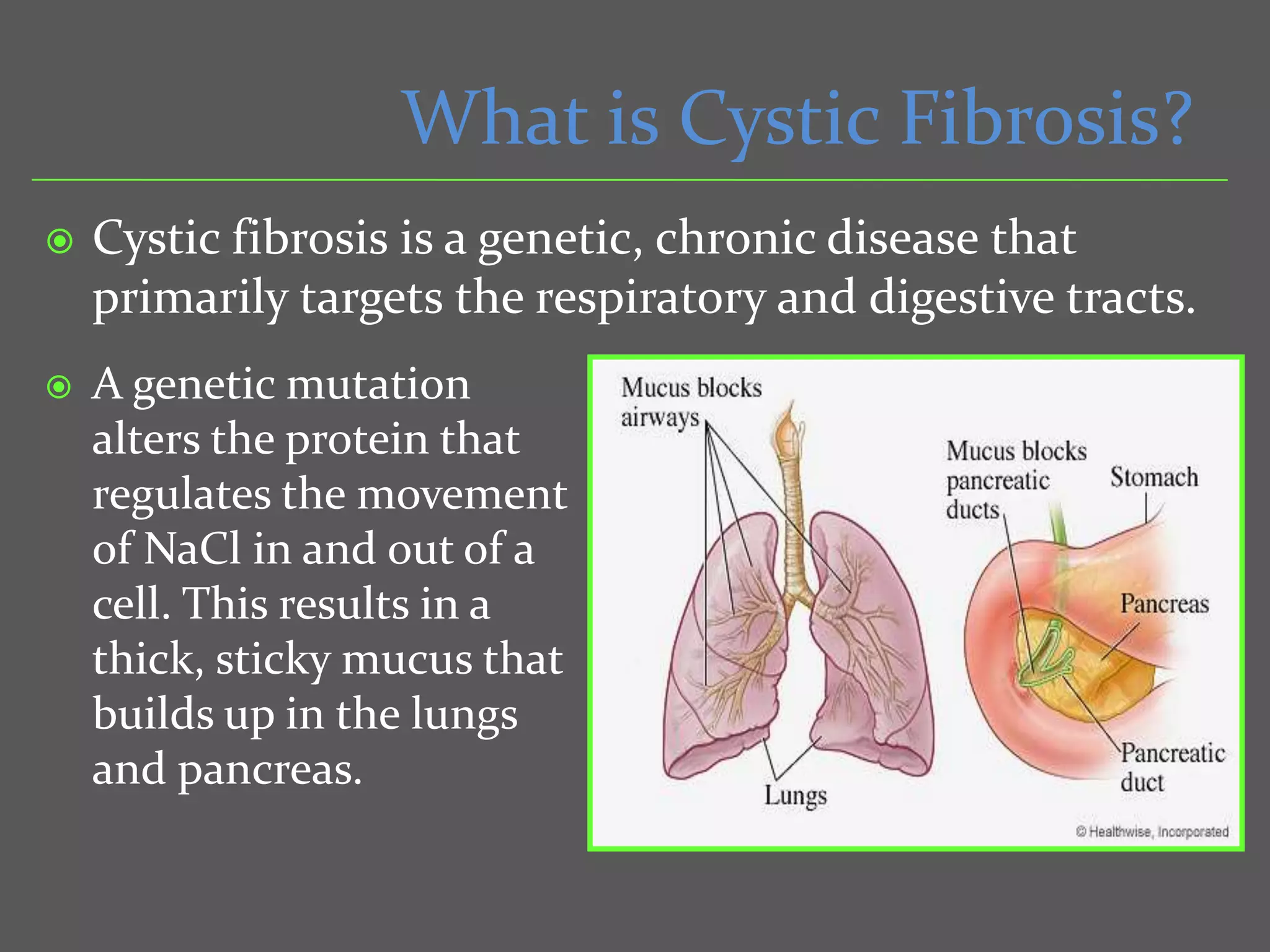 The Truth about Cystic Fibrosis | PPTX