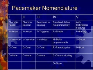 pacer.ppt