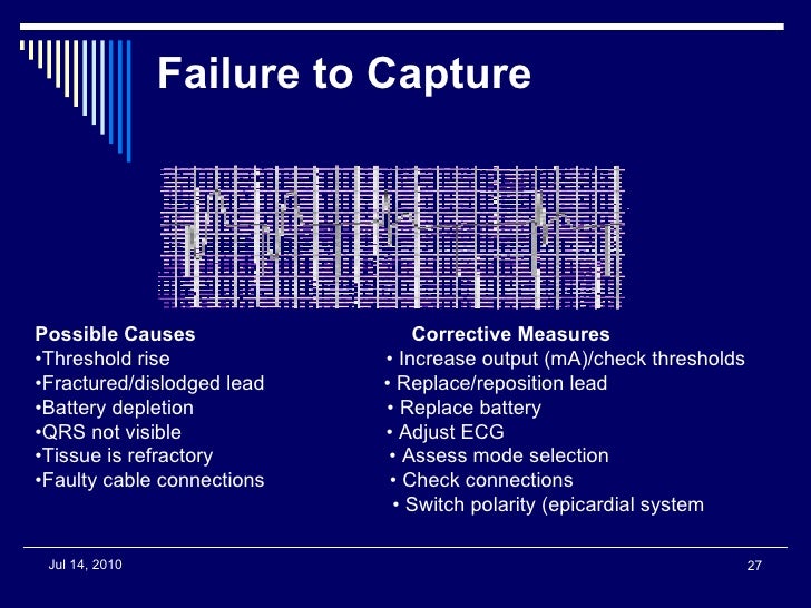 Failure to capture - ingmokasin