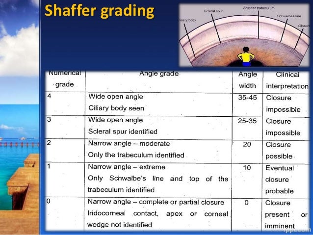 Primary Angle Closure Glaucoma.Dr Ferdous