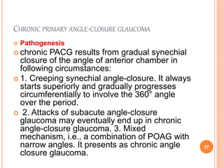 glaucoma | PPT