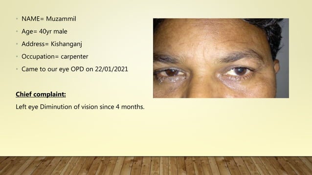 PACG- case presentation | PPTX | Eye and Vision Conditions | Diseases ...