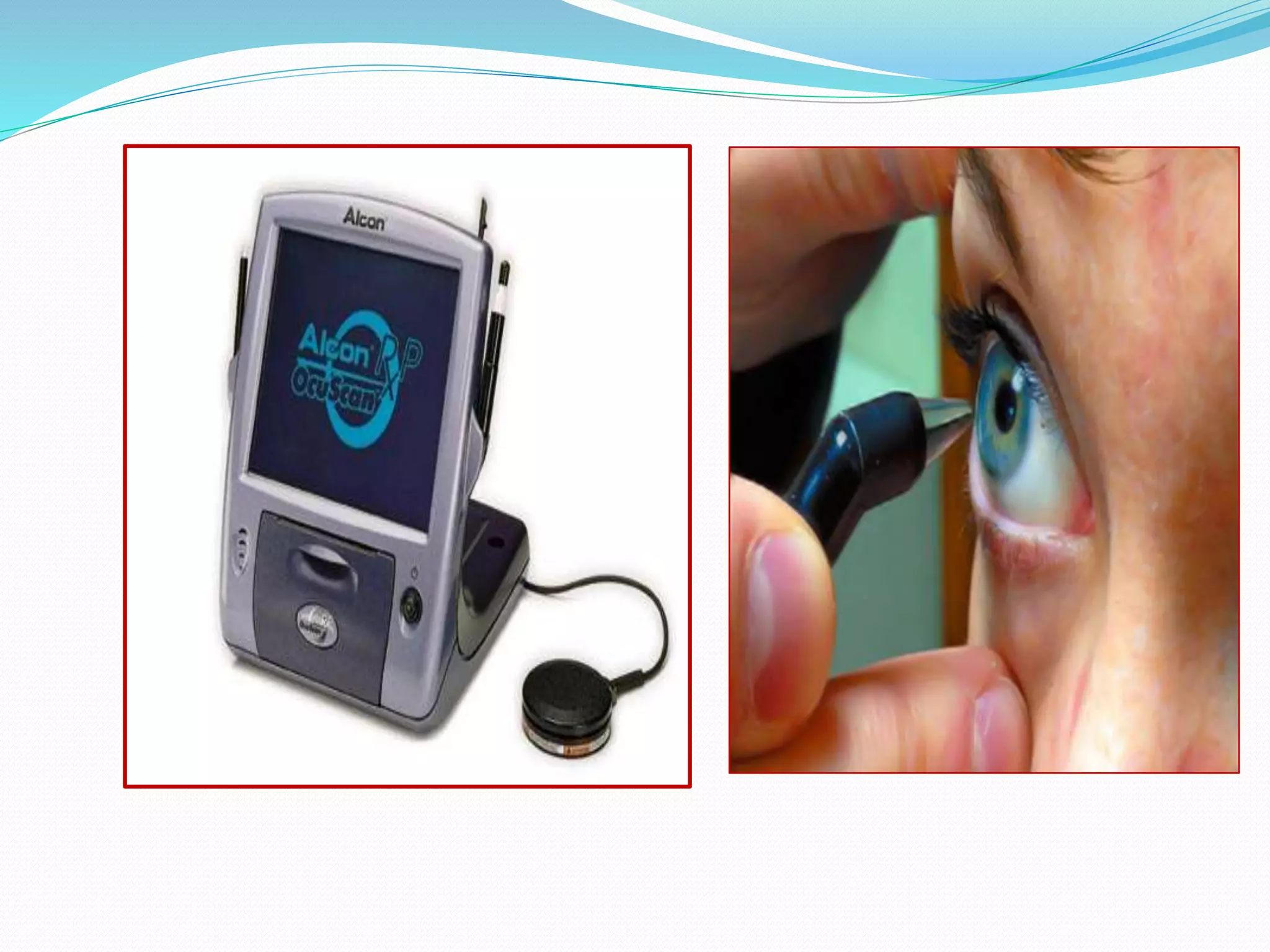 corneal Pachymetry | PPTX | Eye and Vision Conditions | Diseases and ...