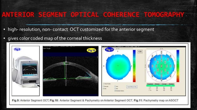 Pachymetry | PPTX | Eye and Vision Conditions | Diseases and Conditions