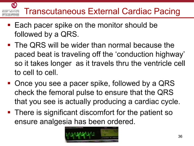 pacing-presentation-notes.pdf | Free Download