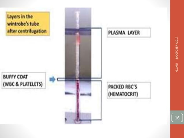 Packed cell volume | PPTX