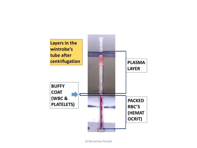 Packed Cell volume estimation.pptx