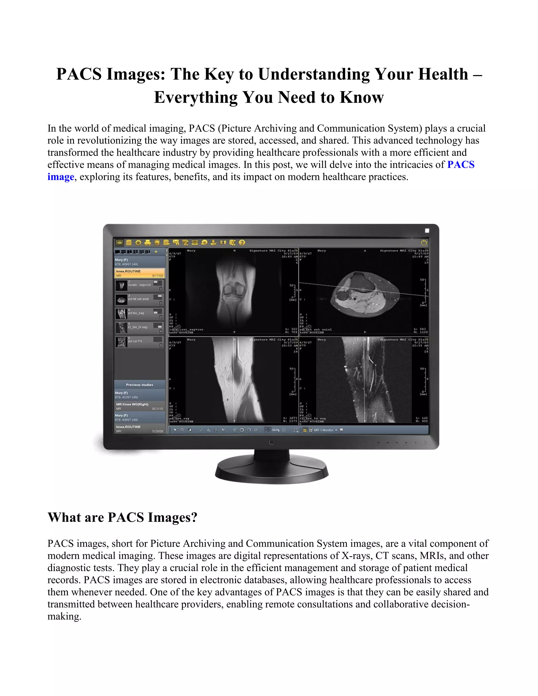 PACS Images The Key to Understanding Your Health – Everything You Need ...