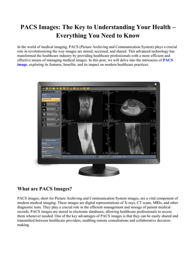 PACS Images The Key to Understanding Your Health – Everything You Need to Know.pdf