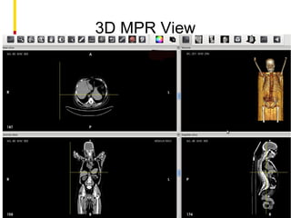 PACS from MedPac Systems | PPT