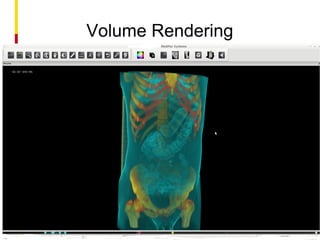 PACS from MEDPAC SYSTEMS | PPT