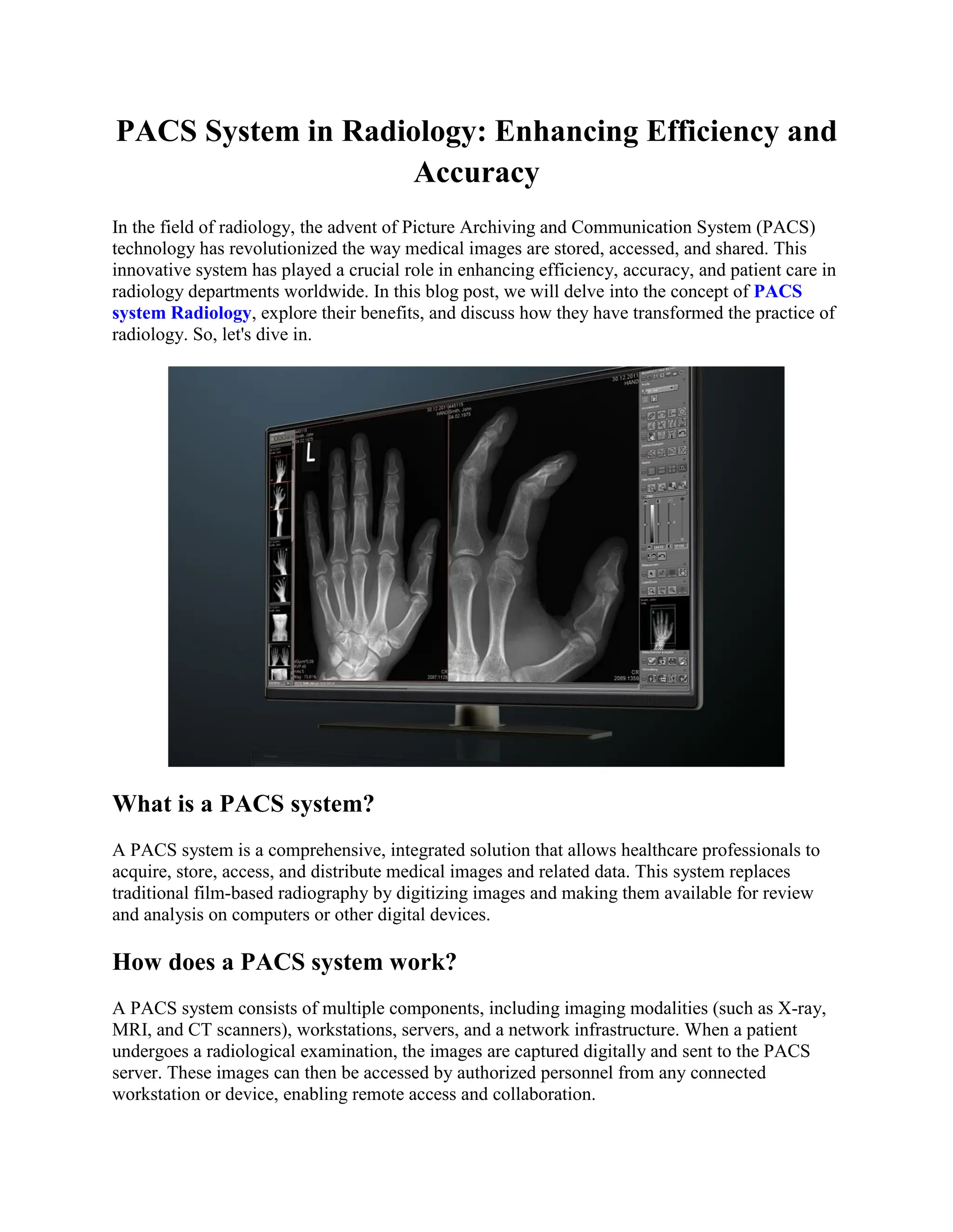 PACS System in Radiology Enhancing Efficiency and Accuracy.pdf