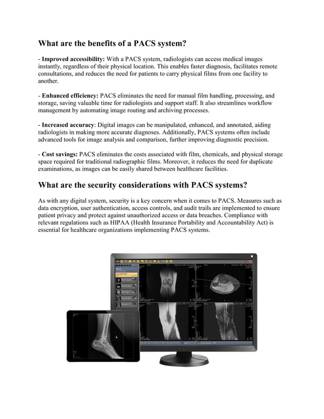 PACS System in Radiology Enhancing Efficiency and Accuracy.pdf