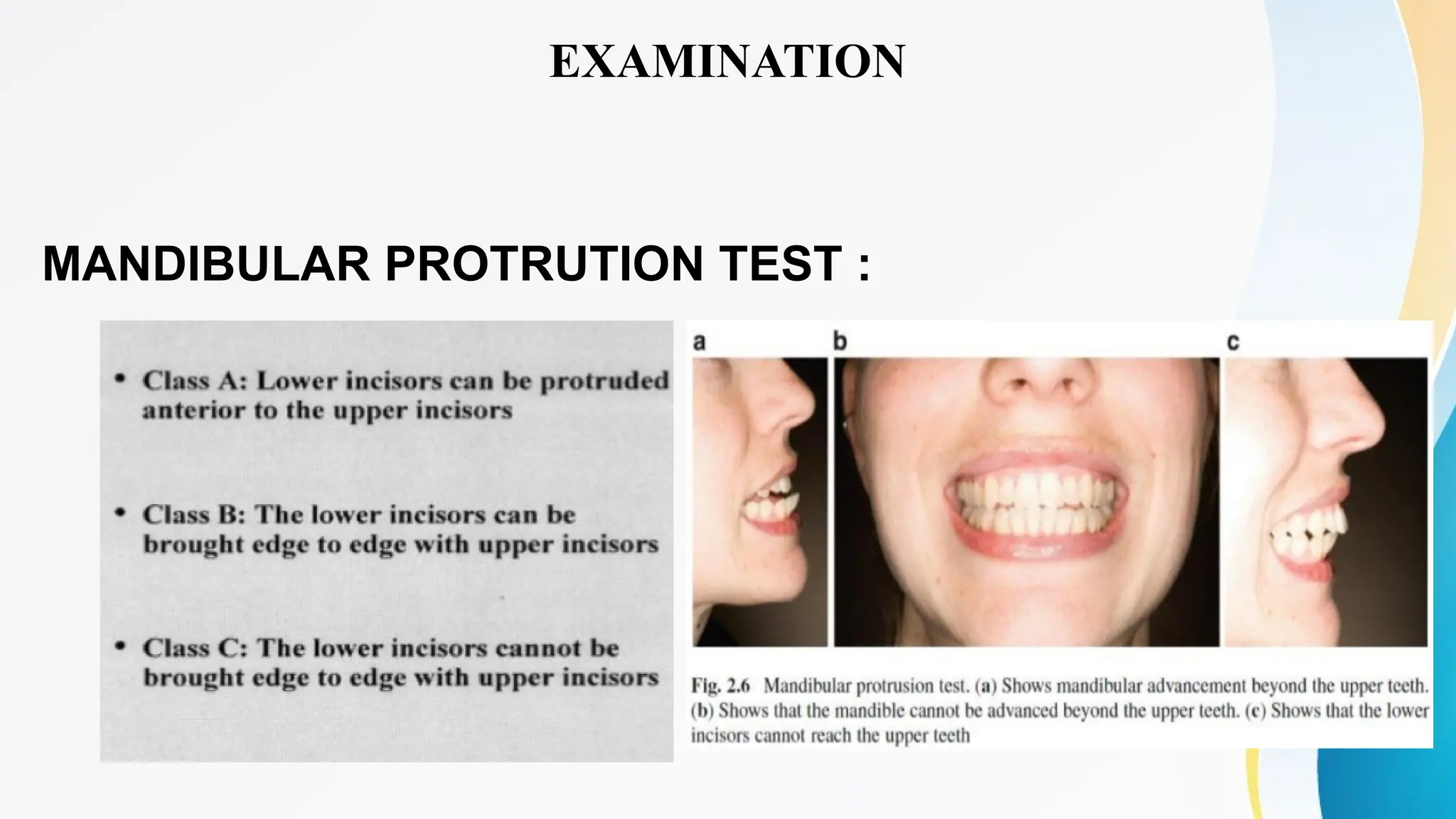 PAC- pre anaesthetic checkup UG lecture.pptx